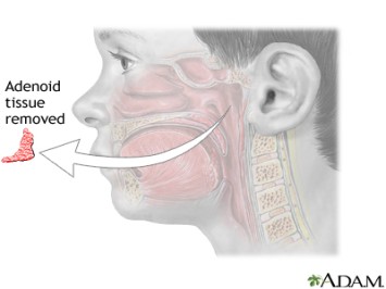 Best ENT Clinic in Delhi at MedFirst ENT Centre